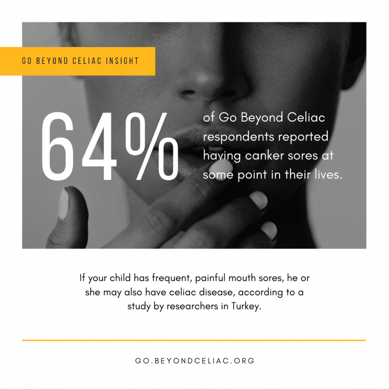 Kids, canker sores and celiac disease | BeyondCeliac.org